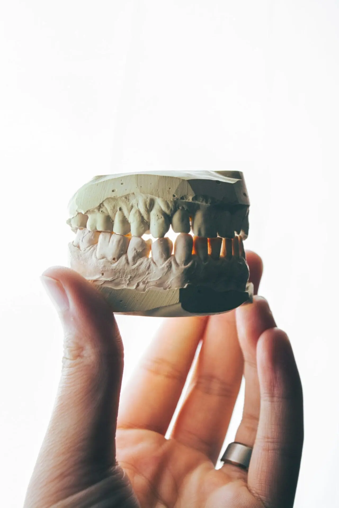 Decaying Teeth: The Lifecycle Of A Surface Cavity