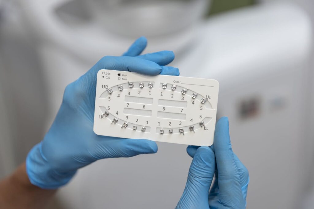 How Are Teeth Supposed To Sit: Teeth Alignment 101 - Shoreline Dental ...